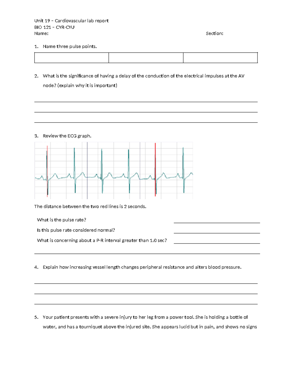 Unit 19 - heart phyiol - Unit 19 – Cardiovascular lab report BIO 121 ...