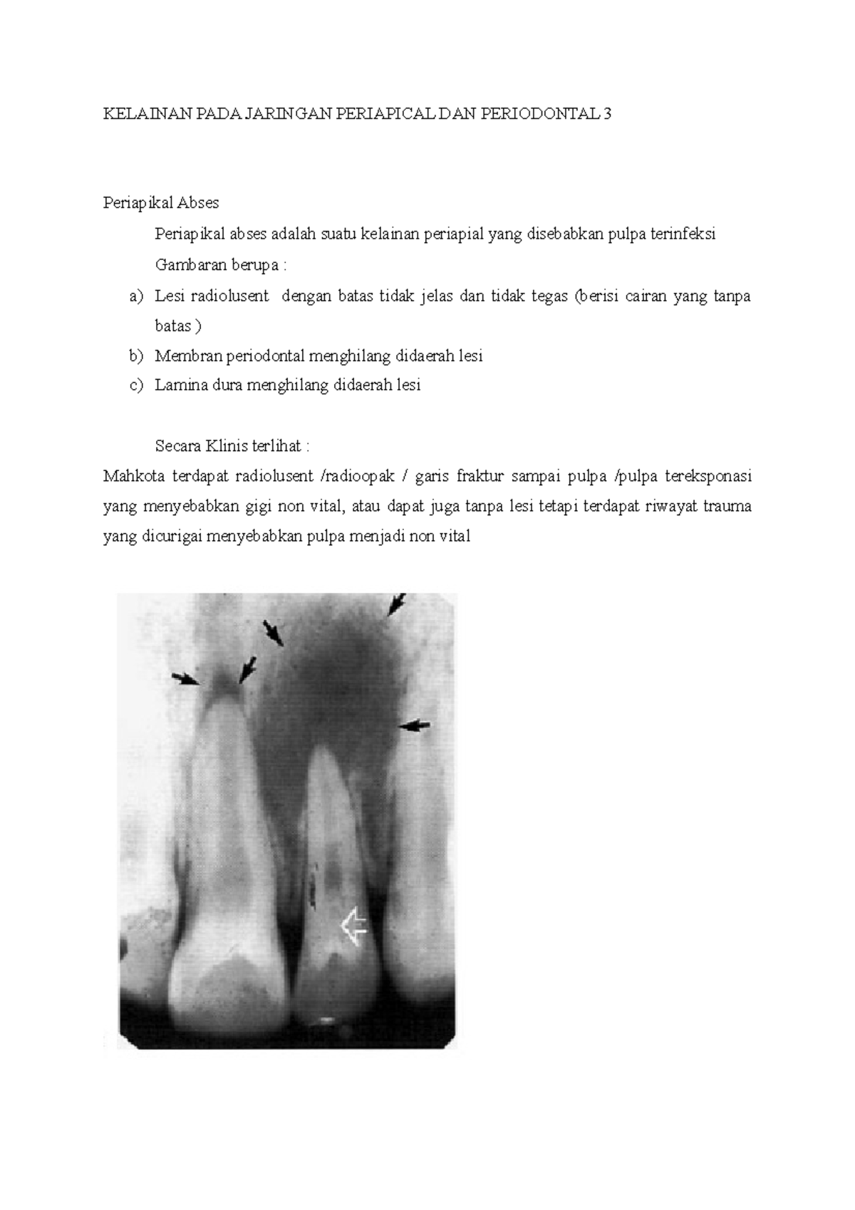 Kelainan Pada Jaringan Periapical Dan Periodontal 3 - KELAINAN PADA ...