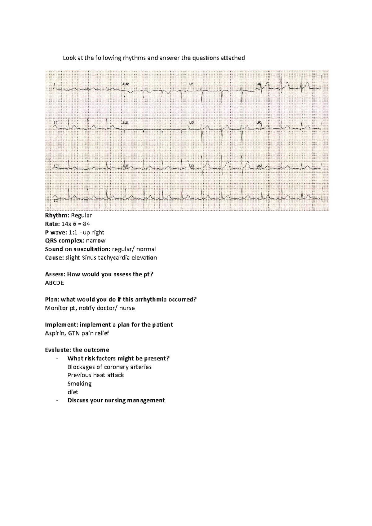 Module 2- ECG practice - notes - Look at the following rhythms and ...