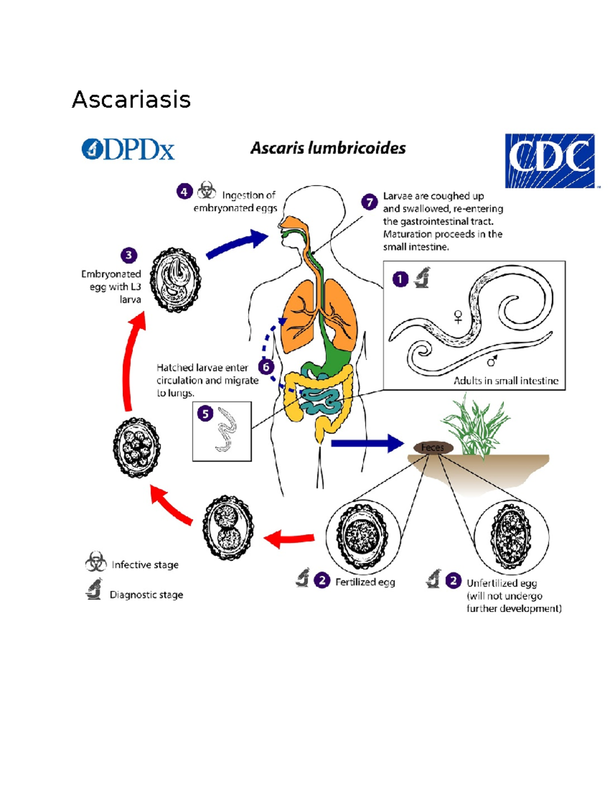 Ascariasis Summary - Ascariasis Adult worms live in the lumen of the ...