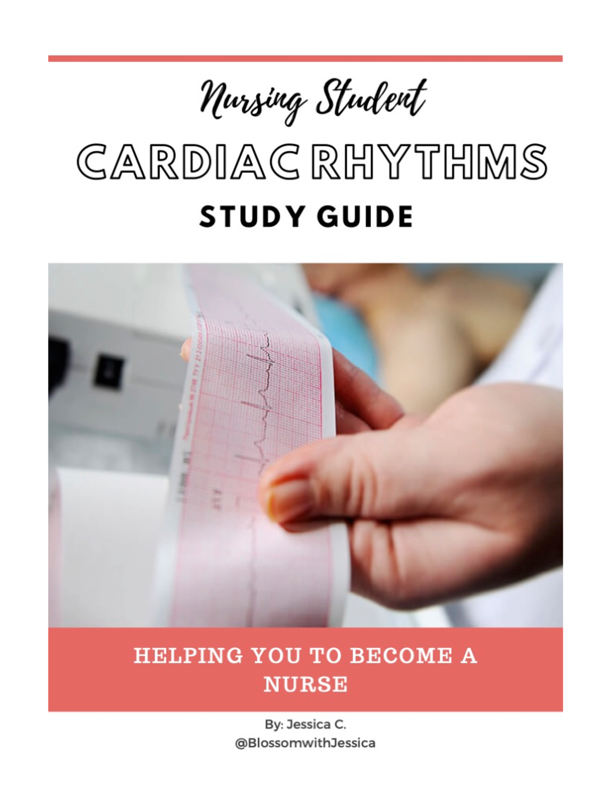 Cardiac EKG - Notes on EKGs - Sinus Bradycardia Criteria Rhythm P wave ...