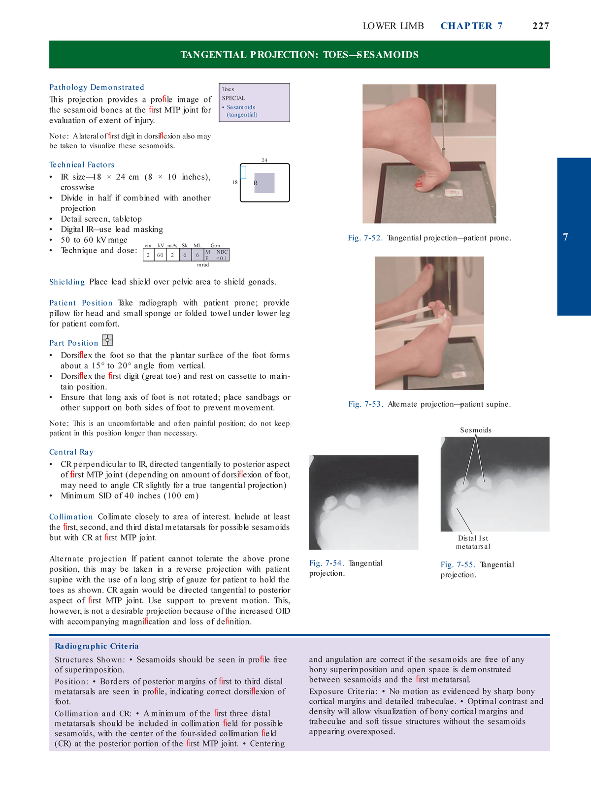 Tangential Projection Toes—sesamoids Lo W E R Li M B Chap Ter 7 227 7 Ta N G E N T I A L P R