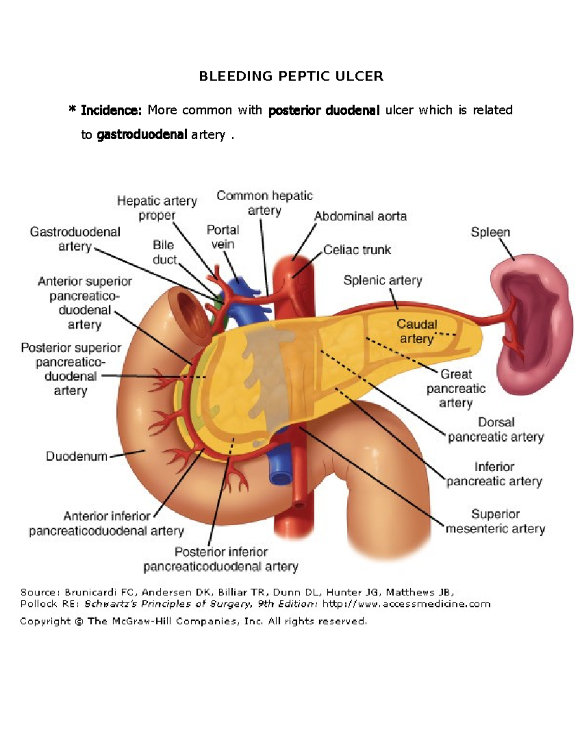 PU bleeding - internal medicine - BLEEDING PEPTIC ULCER Incidence: More ...