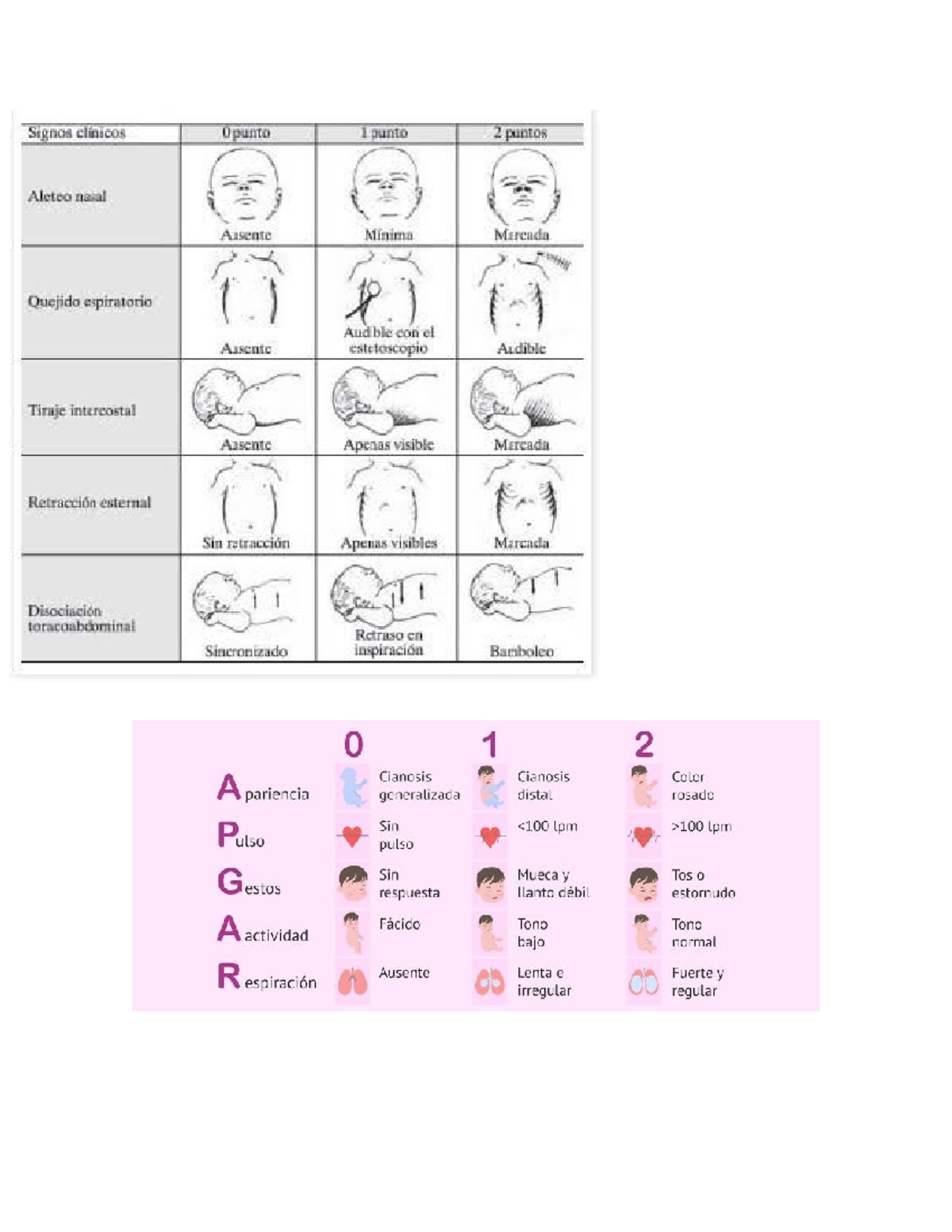 Pediatra - Actividades - Signos clínicos Opunto 1 punto 2 puntos Aleteo ...
