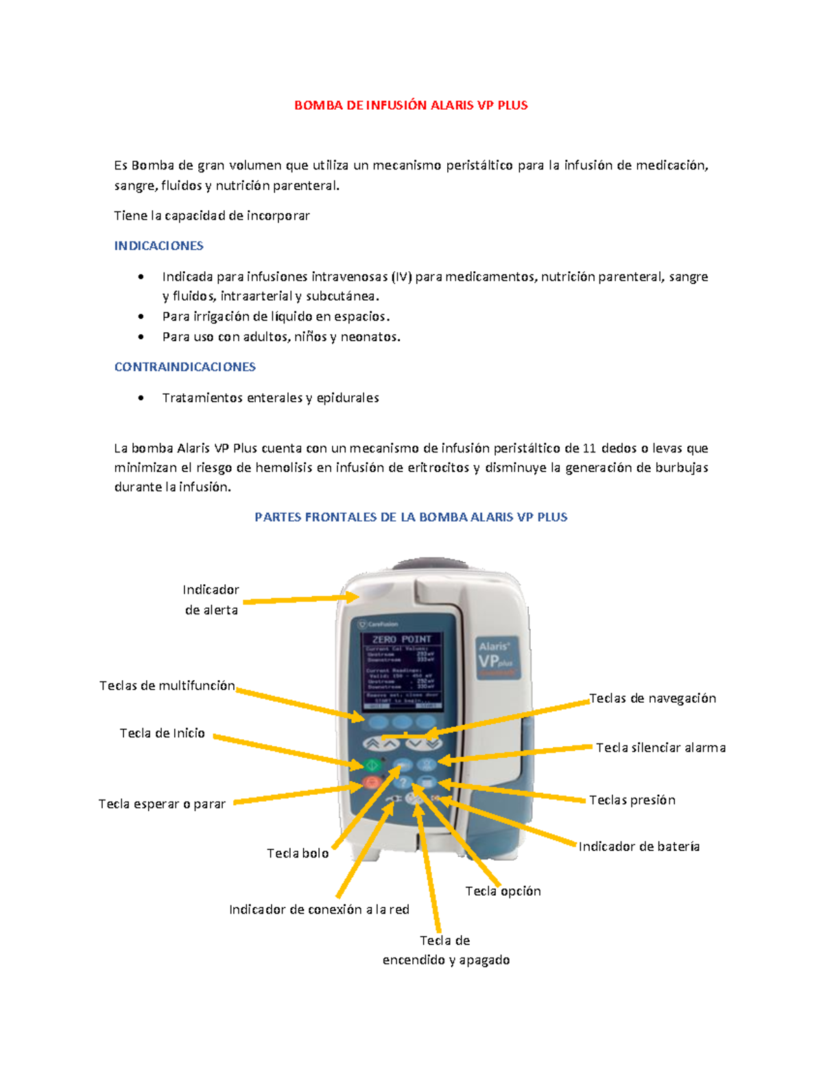 Bomba de infusión Alaris VP PLUS- HNM - BOMBA DE INFUSI”N ALARIS VP ...