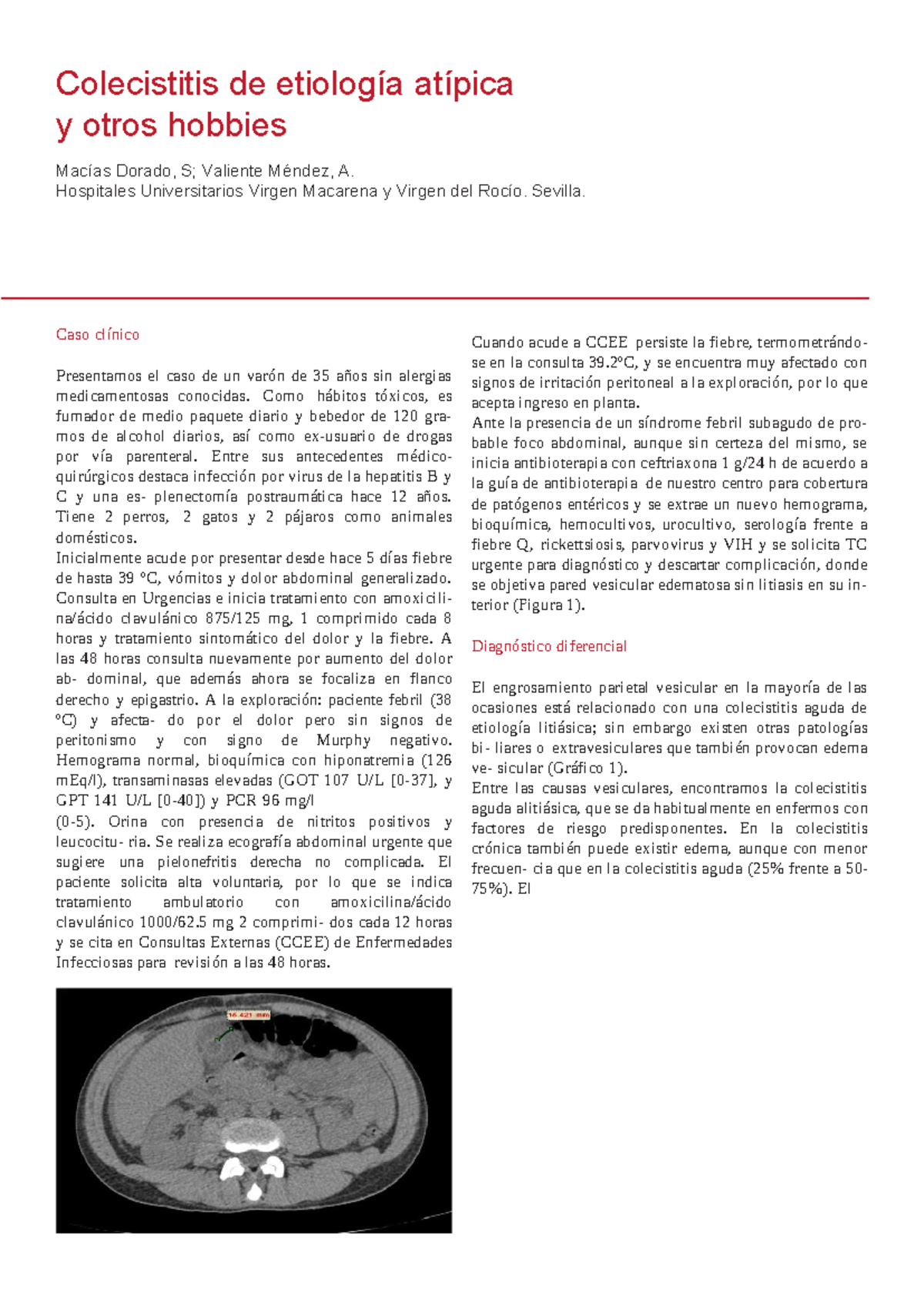 CASO clinico antibioticos generalidades - Colecistitis de etiología ...