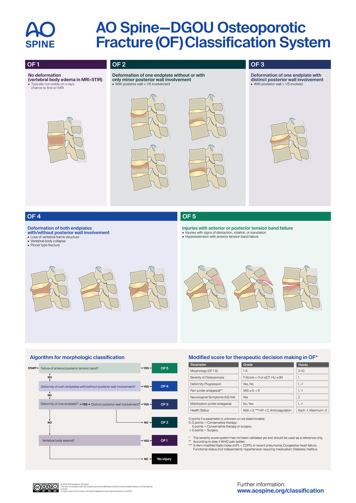 AO Spine Osteoporotic Classification Poster - OF 4 OF 5 AO Spine—DGOU ...