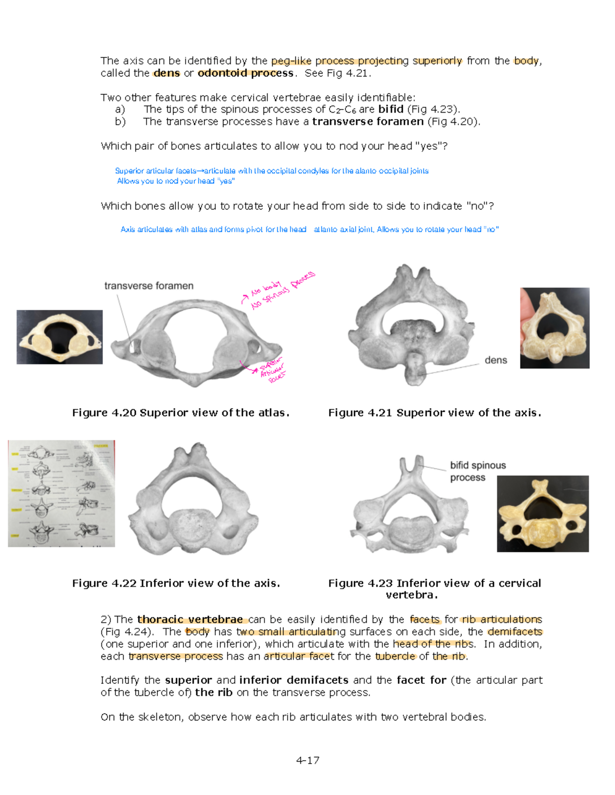 LAB 4 - Axial Skeleton 6 - Lab 4 - answer key - 4- The axis can be identified by the peg-like ...