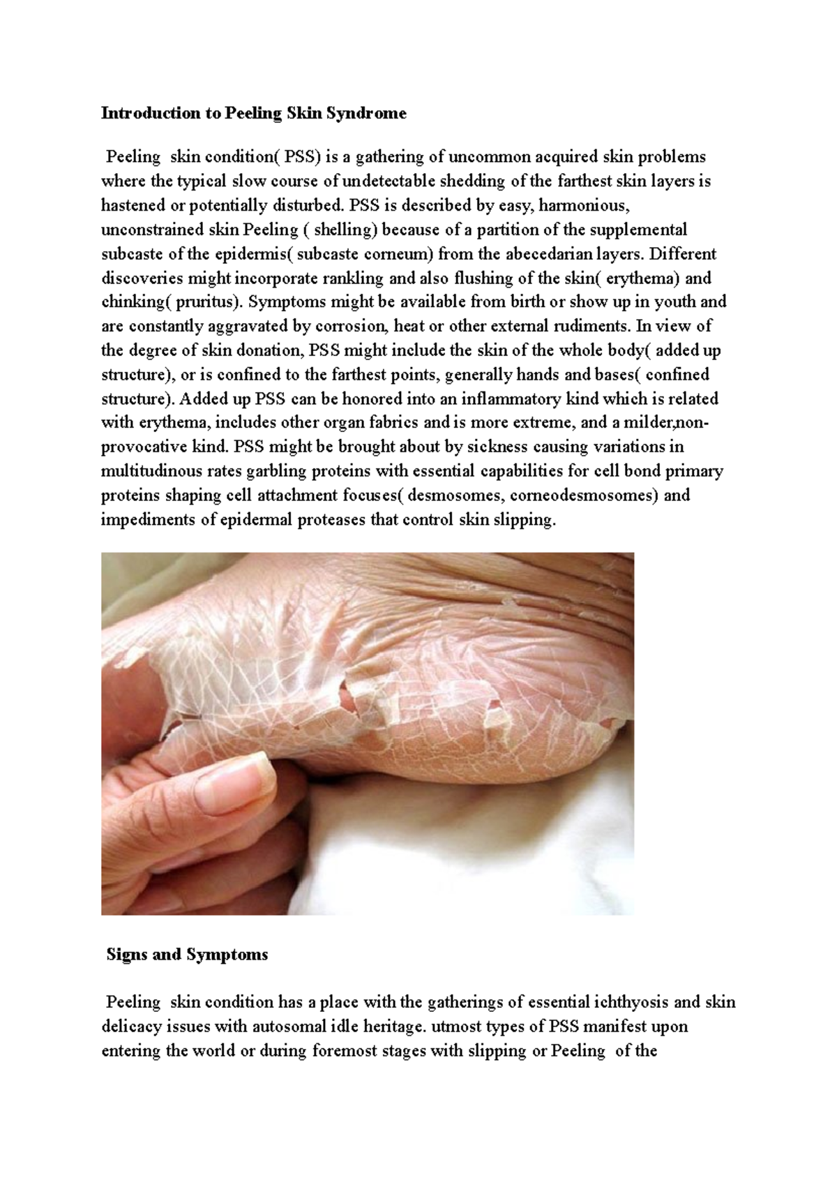 Introduction to Peeling Skin Syndrome - PSS is described by easy ...