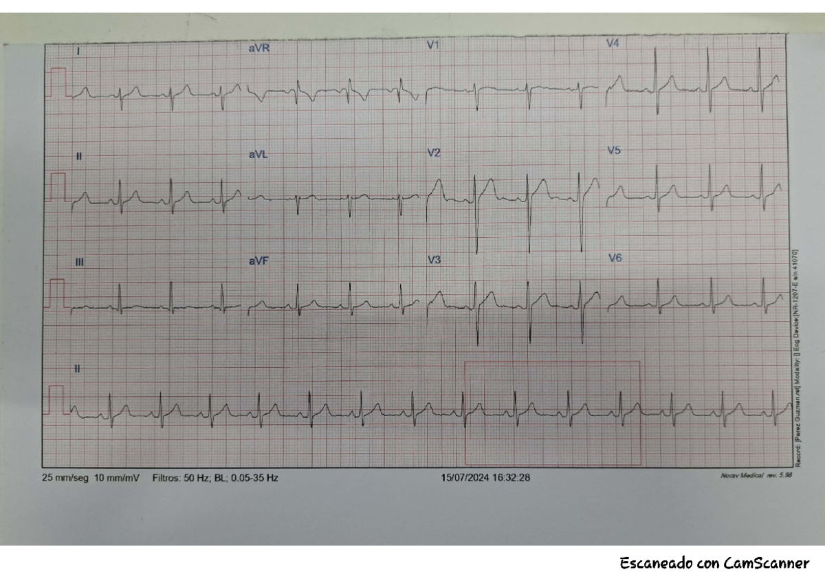 Ejemplo de electrocardiograma para practica - Fisiología - I aVR V1 V4 rm II aVL V2 V5 III aVF ...