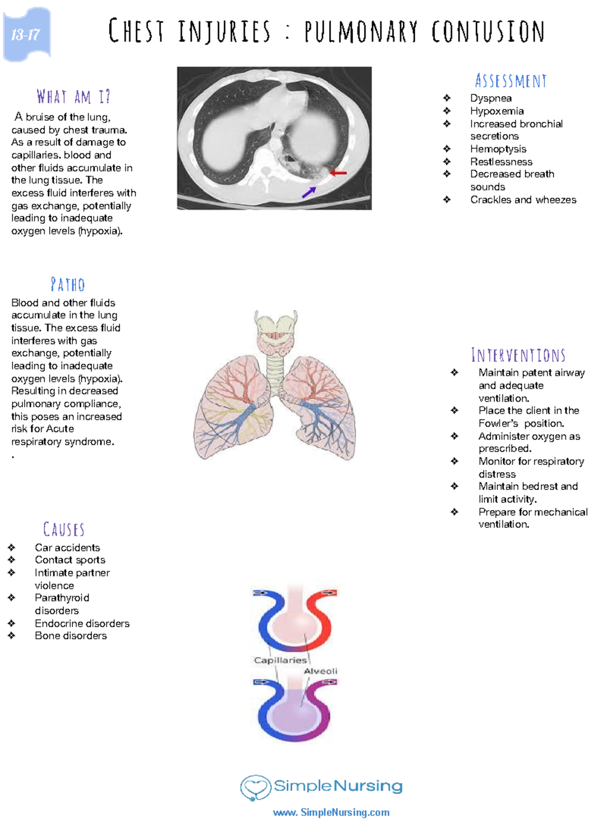 Pulmonary Contusion - Med surg - 13- http://www. SimpleNursing Chest ...