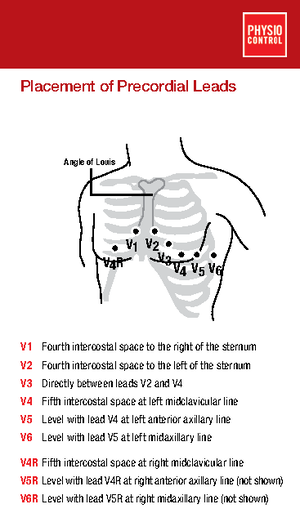 ECG Waves AND Complexes - ECG WAVES AND COMPLEXES QT INTERVAL ...