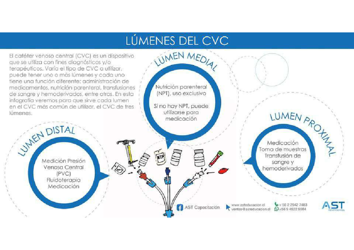 CVC - CVC - LÚMENES DEL CVC El catéter venoso central (CVC) es un dispositivo que se utiliza con ...