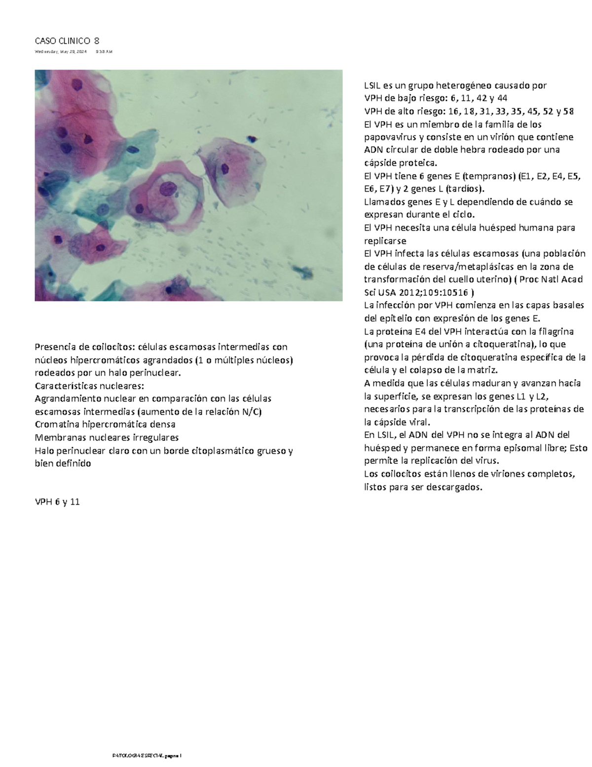 CASO Clinico de VPH - Presencia de coilocitos: células escamosas ...