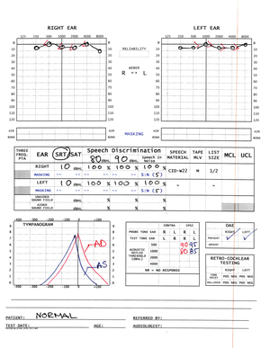 Pathology Chart 2018 - Condition/Etiology Otoscopic Examination DP OAEs ...