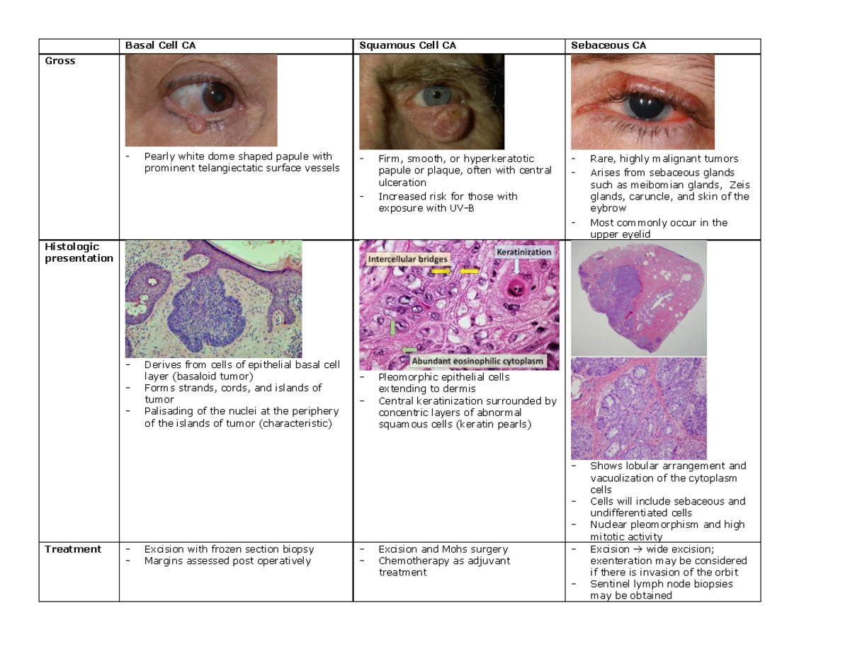 CA - Summary Doctor of Medicine - Basal Cell CA Squamous Cell CA ...