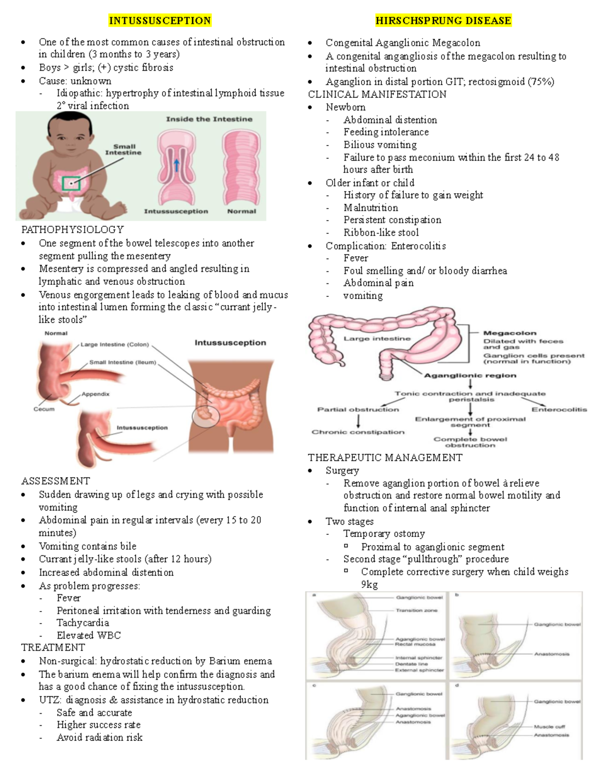 NCMA219 RLE MIDTERM - INTUSSUSCEPTION One of the most common causes of ...