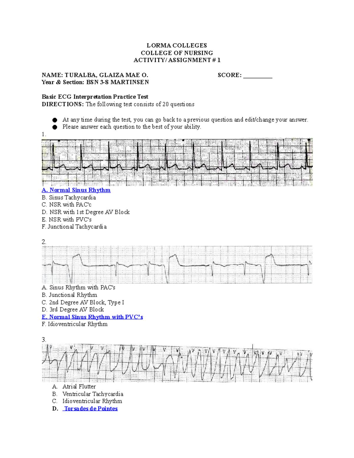 ECG Interpretation (Activity #1) - Lorma Colleges 2023 - LORMA COLLEGES ...