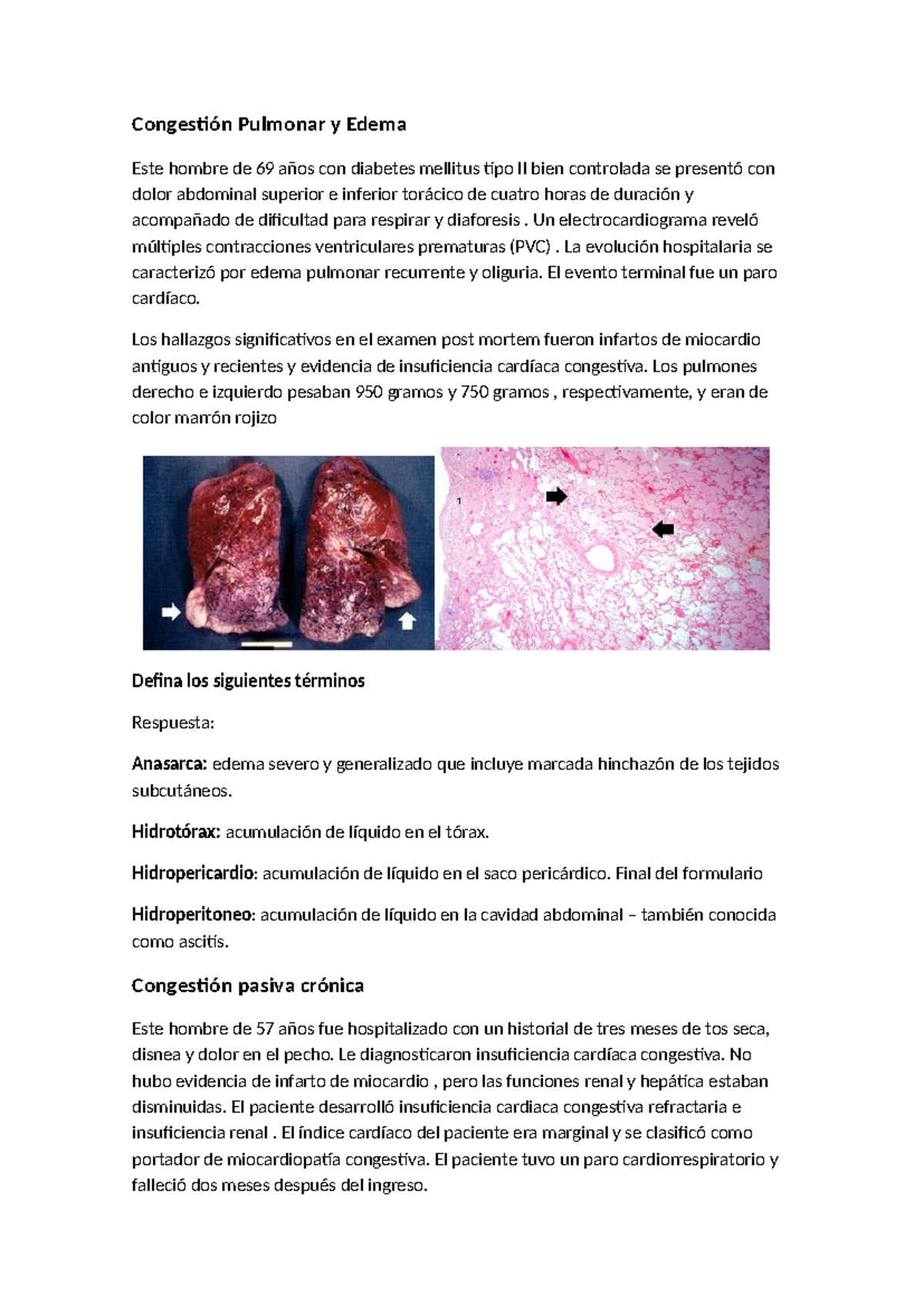 Congestión Pulmonar y Edema - Congestión Pulmonar y Edema Este hombre ...