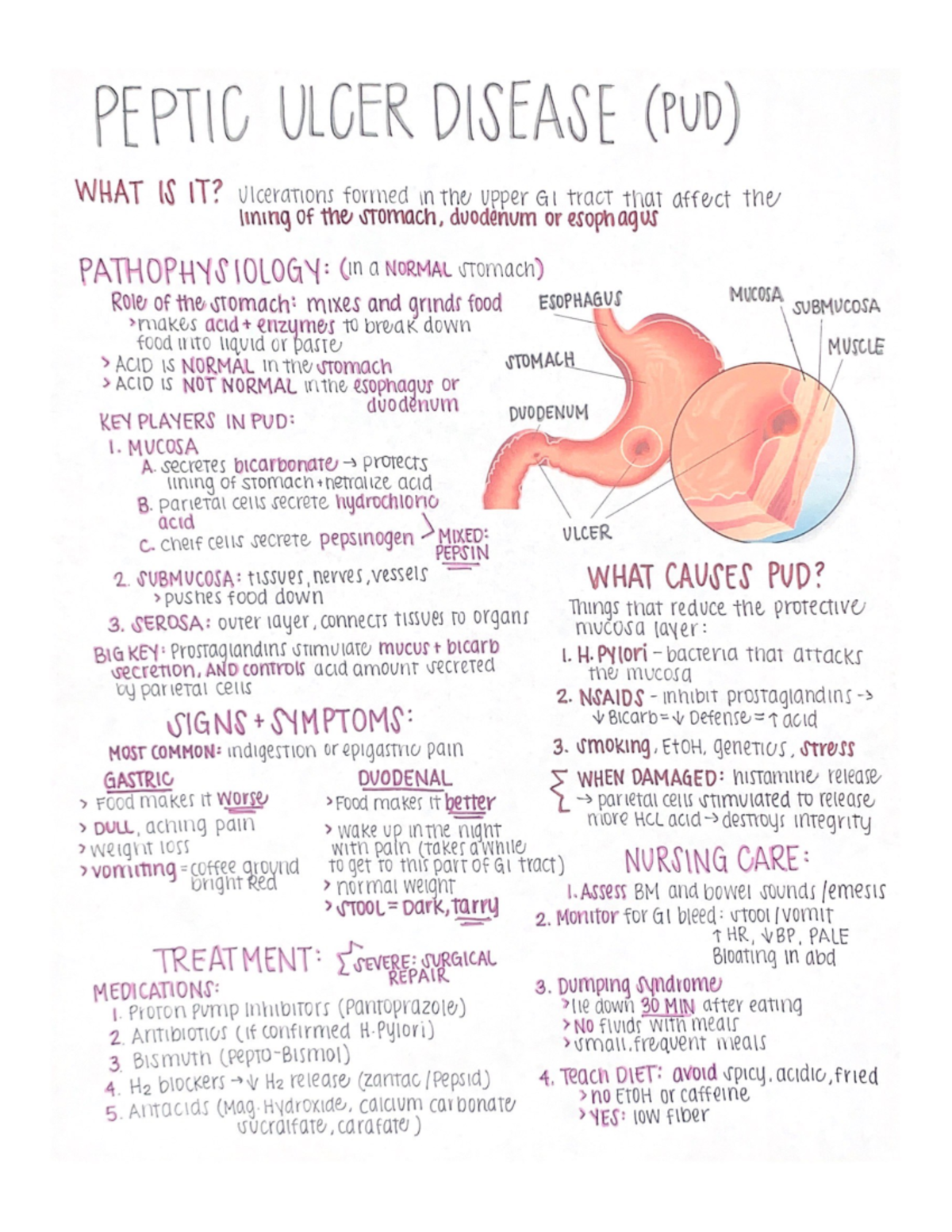 Peptic Ulcer Disease - Notes - NUR 322 - Studocu