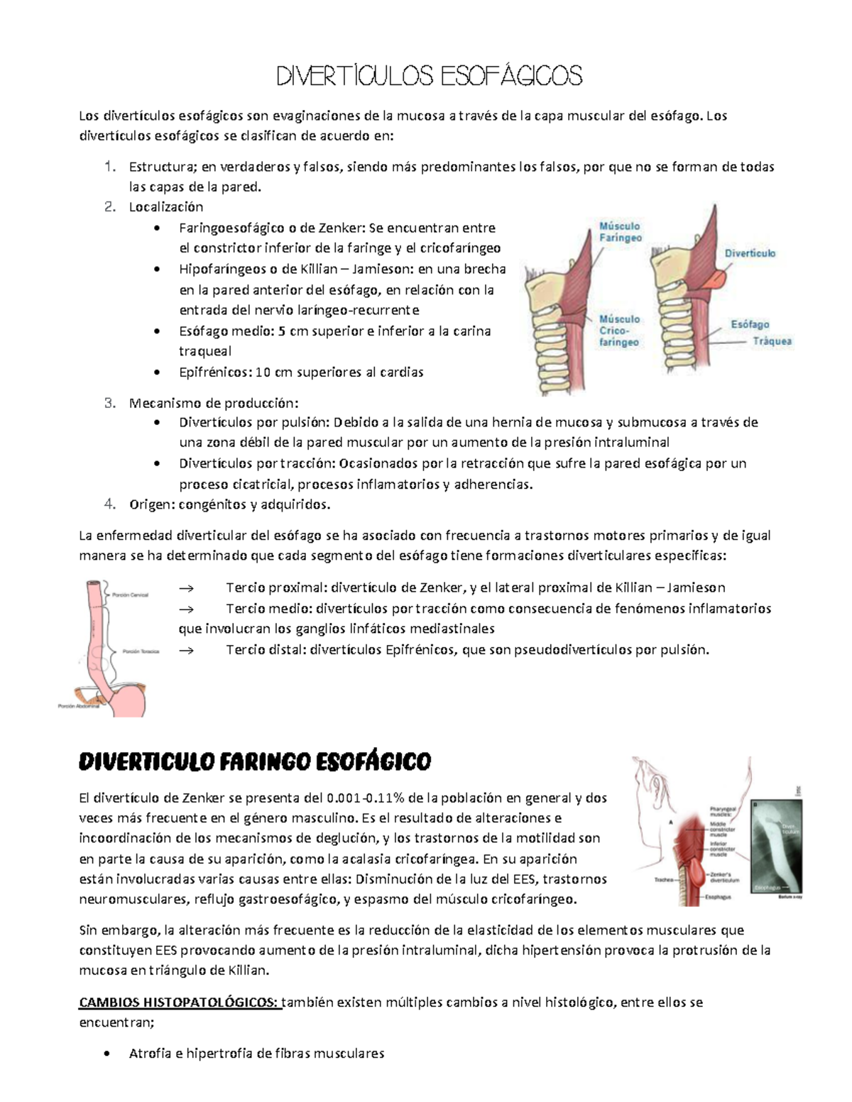 52,39,48. Divertículos Esofágicos, EB Y CA DE Esófago - DIVERTÕCULOS ...