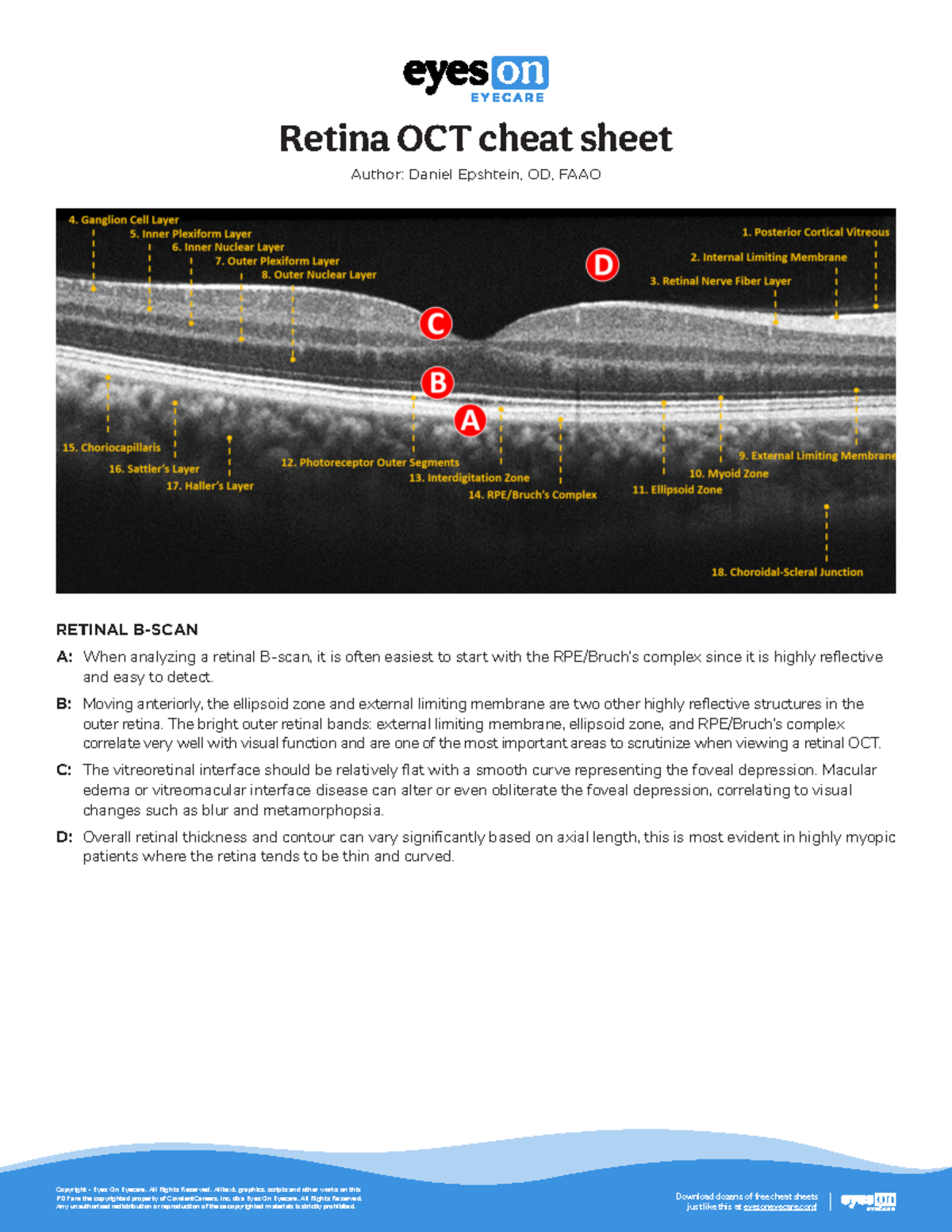 Retina OCT - Oct layers - Retina OCT cheat sheet Author: Daniel ...