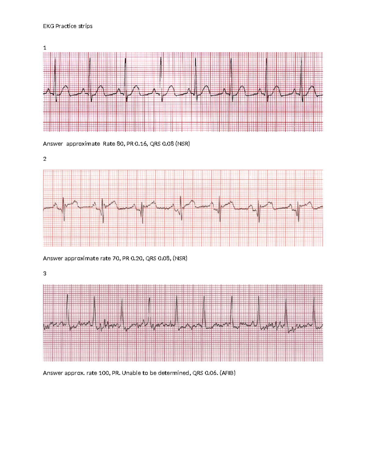 EKG PRACTICE (ANSWERS) - 1 Answer approximate Rate 80, PR 0, QRS 0 (NSR ...