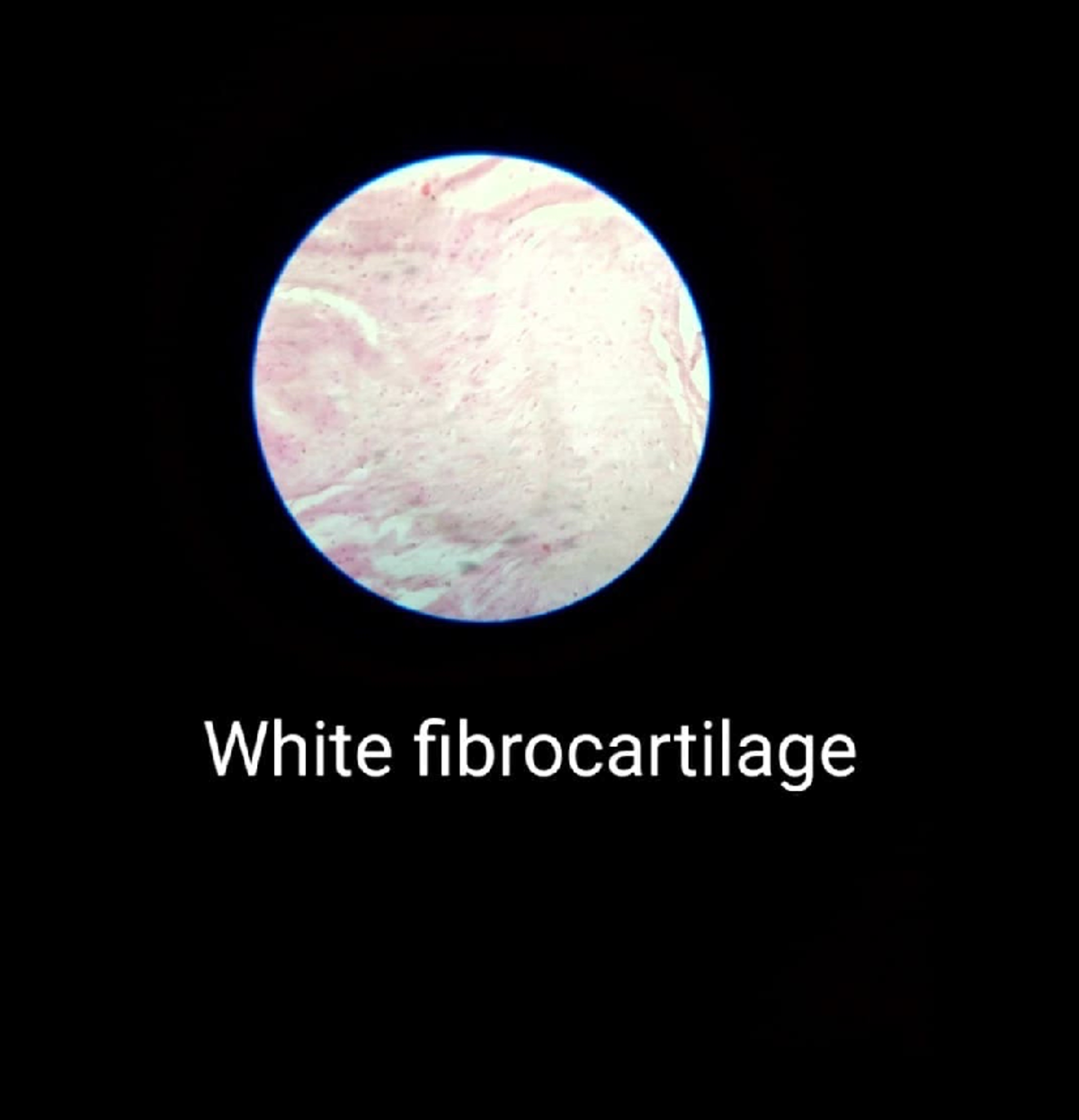 Histology Slides - anatomy - White fibrocartilage Spinal ganglion Loose ...
