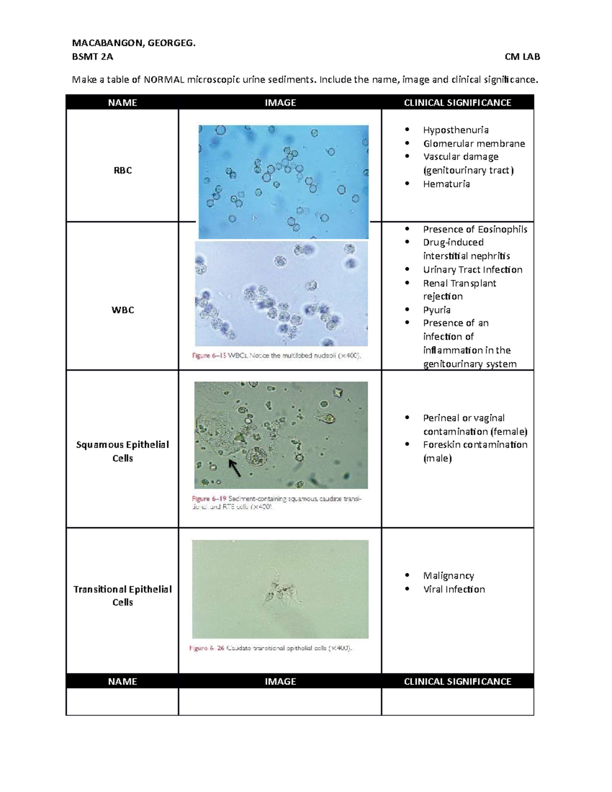 NORMAL URINE SEDIMENTS - BSMT 2A CM LAB Make a table of NORMAL ...