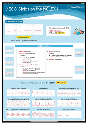ECG Strips - Normal sinus rhythm Treatment: None continue to monitor ...