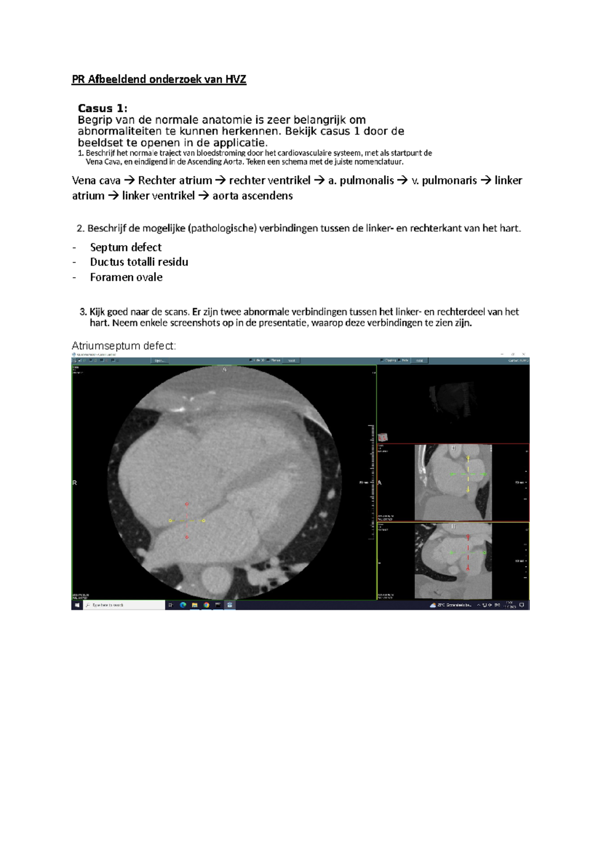 PR afbeeldend onderzoek - pulmonalis v. pulmonaris linker atrium linker ...