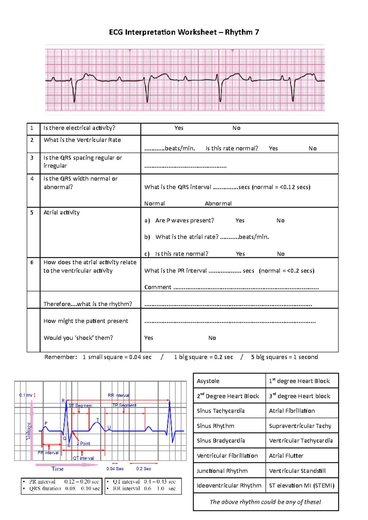 Rhythm 7 - ECG Interpretation Worksheet – Rhythm 7 1 Is there ...