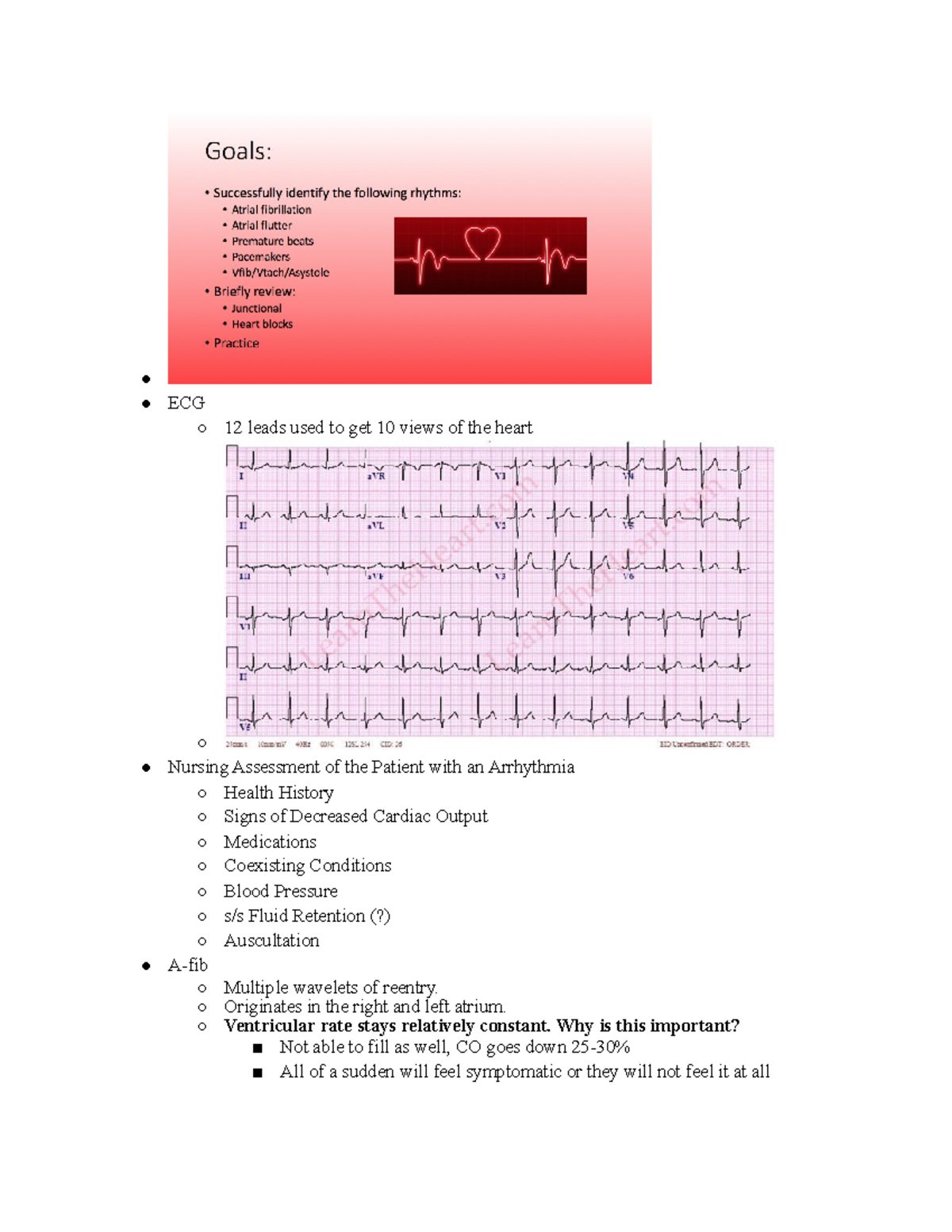 Ch. 26 - Management of Patients with Dysrhythmias and Conduction ...