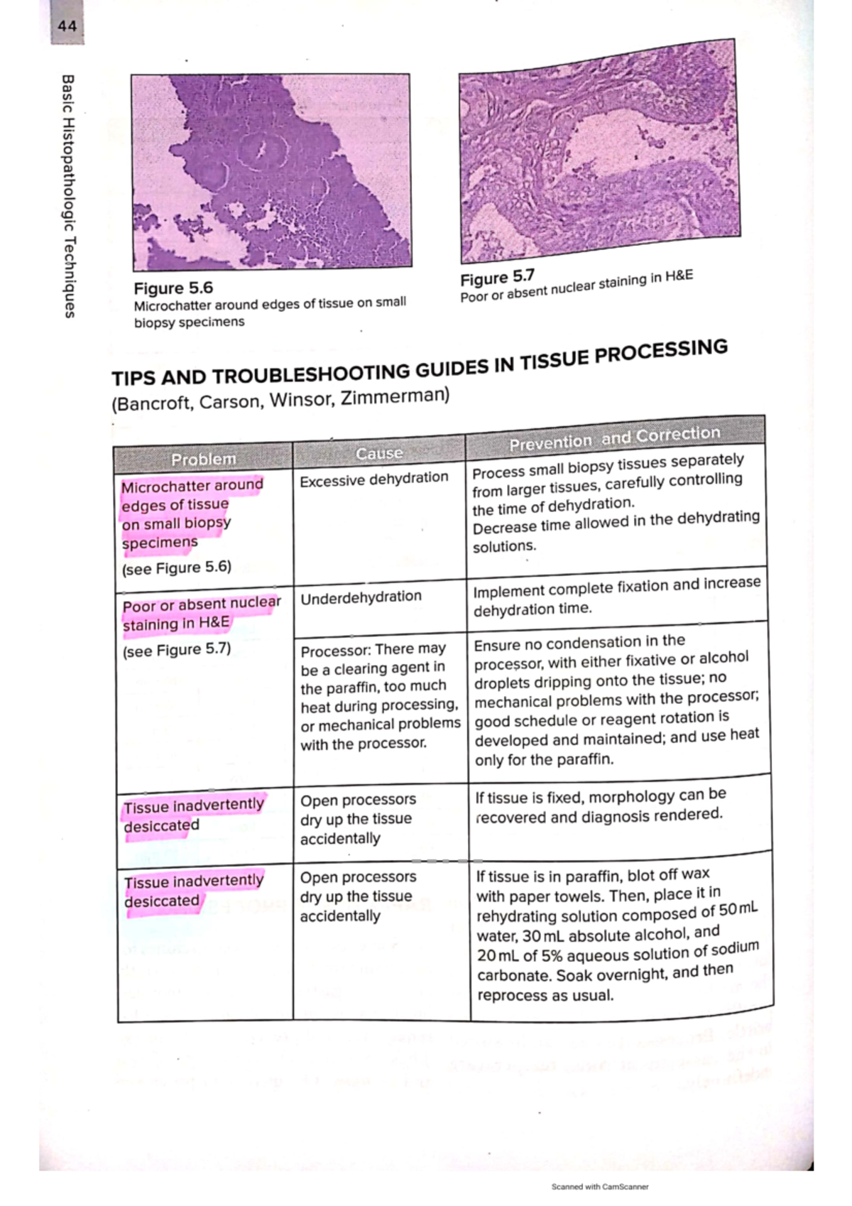 Raymundo Histopath tablesss - 44 Figure 5 Poor Figure or absent nuclear ...