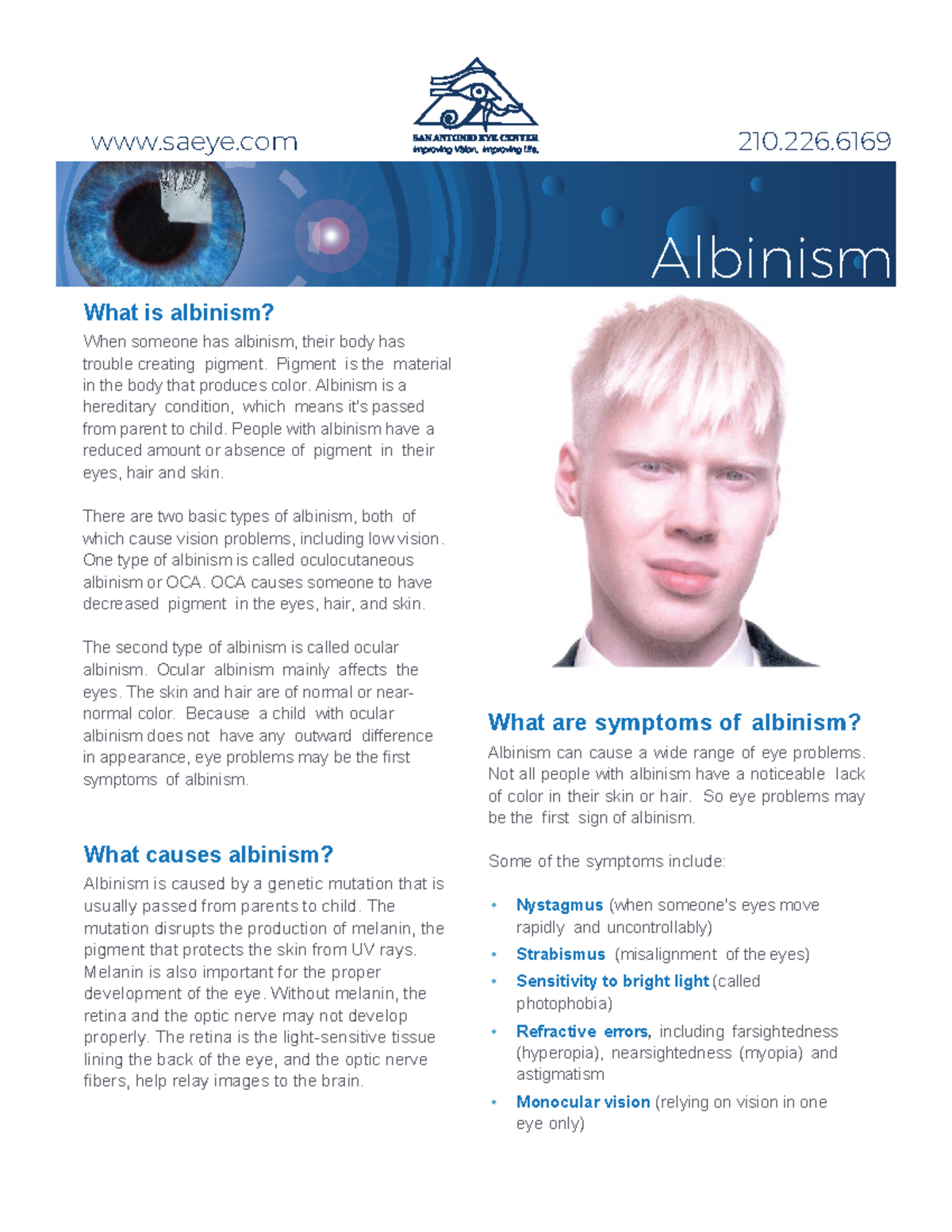 Albinism - wer5y67u78i8 - saeye 210. Albinism What is albinism? When ...