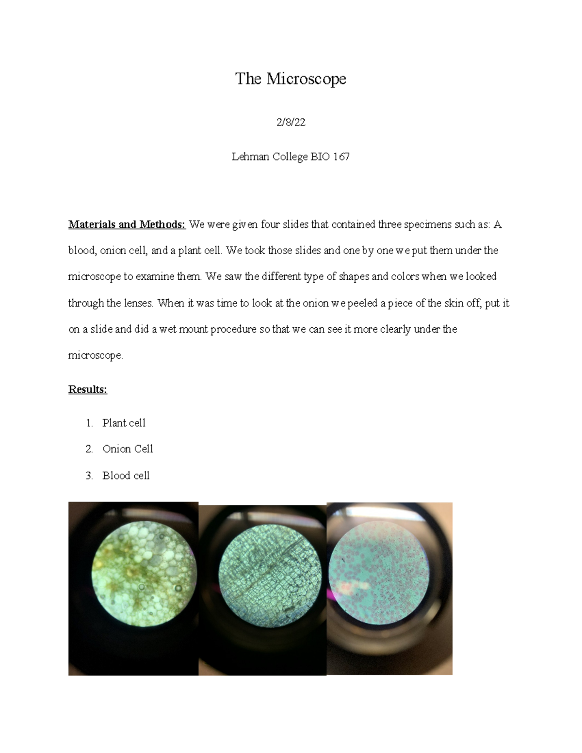 BIO 167 LAB Report 1 - The Microscope 2/8/ Lehman College BIO 167 ...