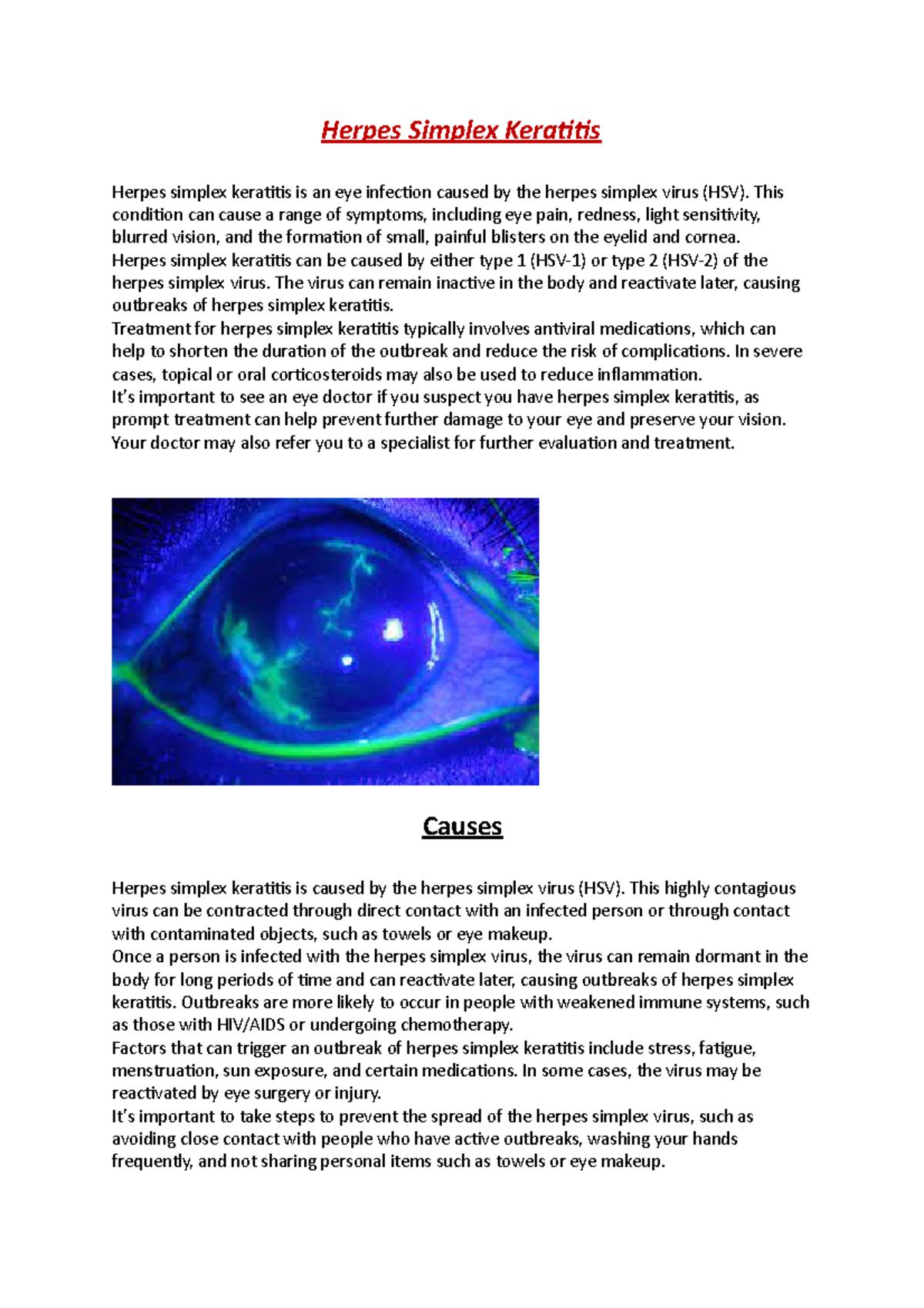 Herpes Simplex Keratitis - Herpes Simplex Keratitis Herpes simplex ...