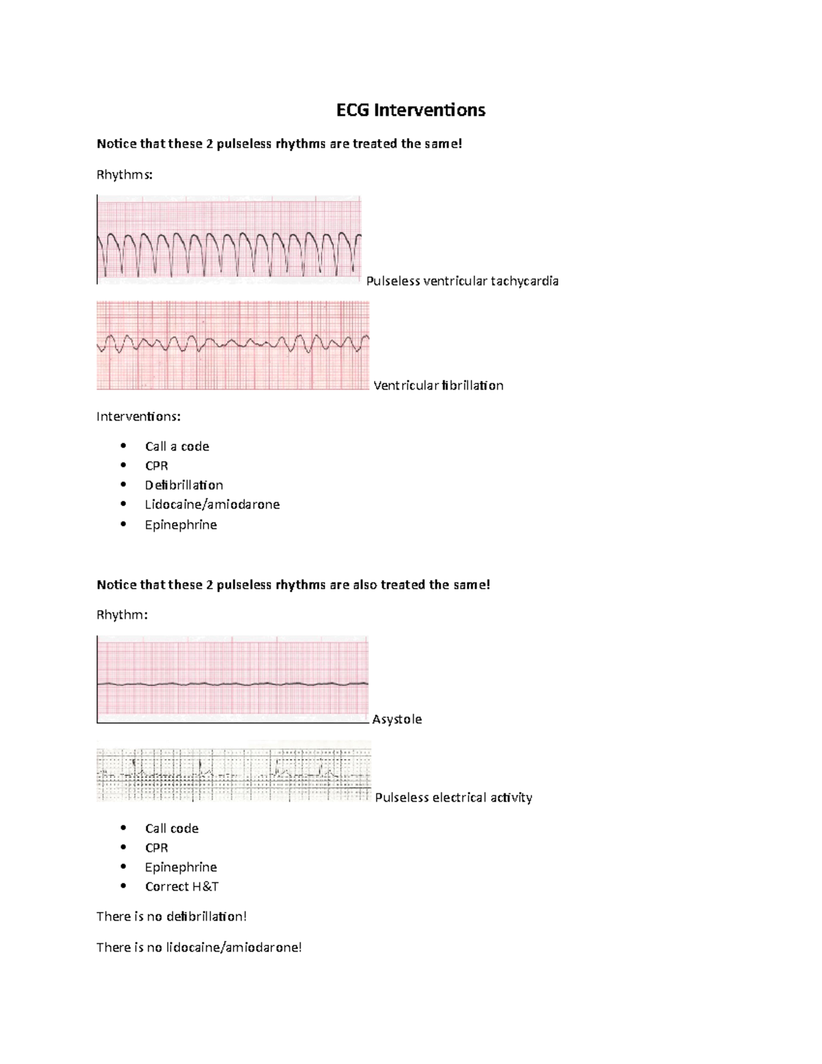 ECG Interventions - cardiac notes! - ECG Interventions Notice that ...