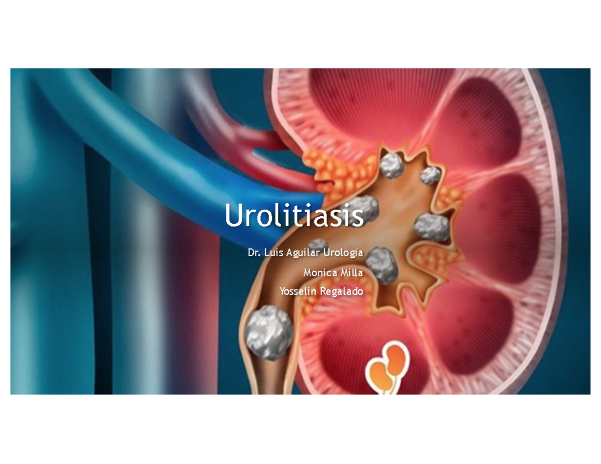 Urolitiasis (1) - Solo lectura - Urolitiasis Dr. Luis Aguilar Urología ...