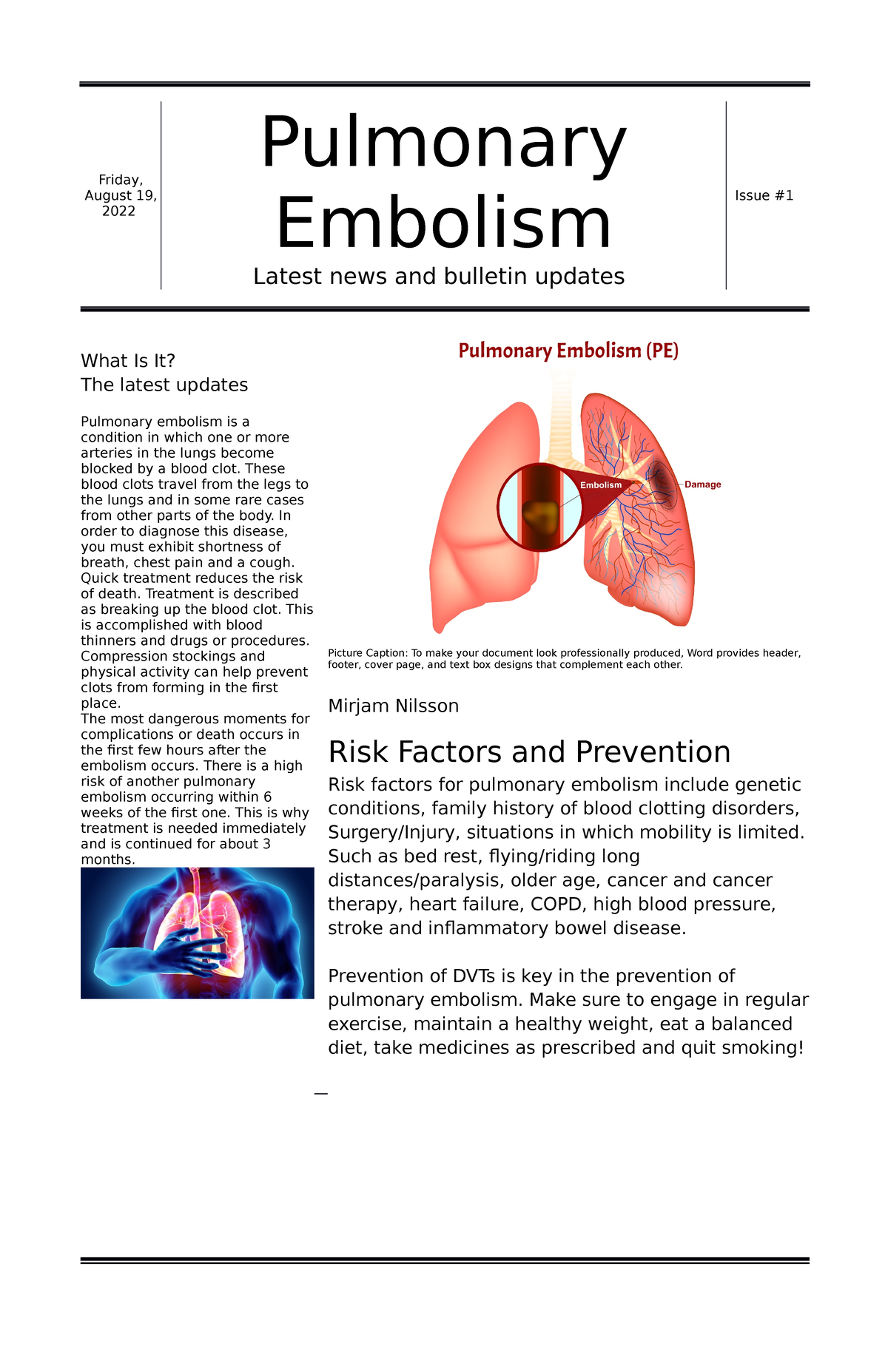 Patient teaching handout - Friday, August 19, 2022 Pulmonary Embolism ...