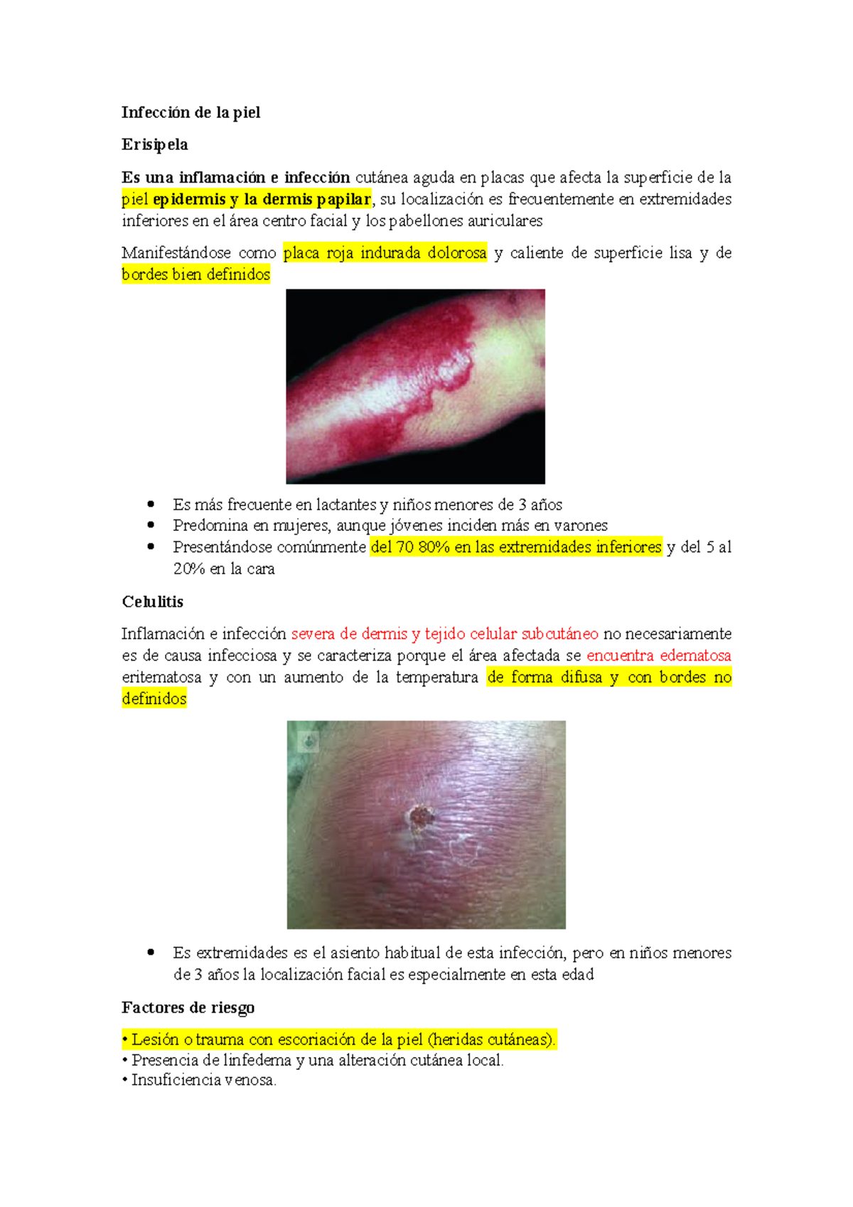 Infección de la piel - pediatria - Infección de la piel Erisipela Es ...