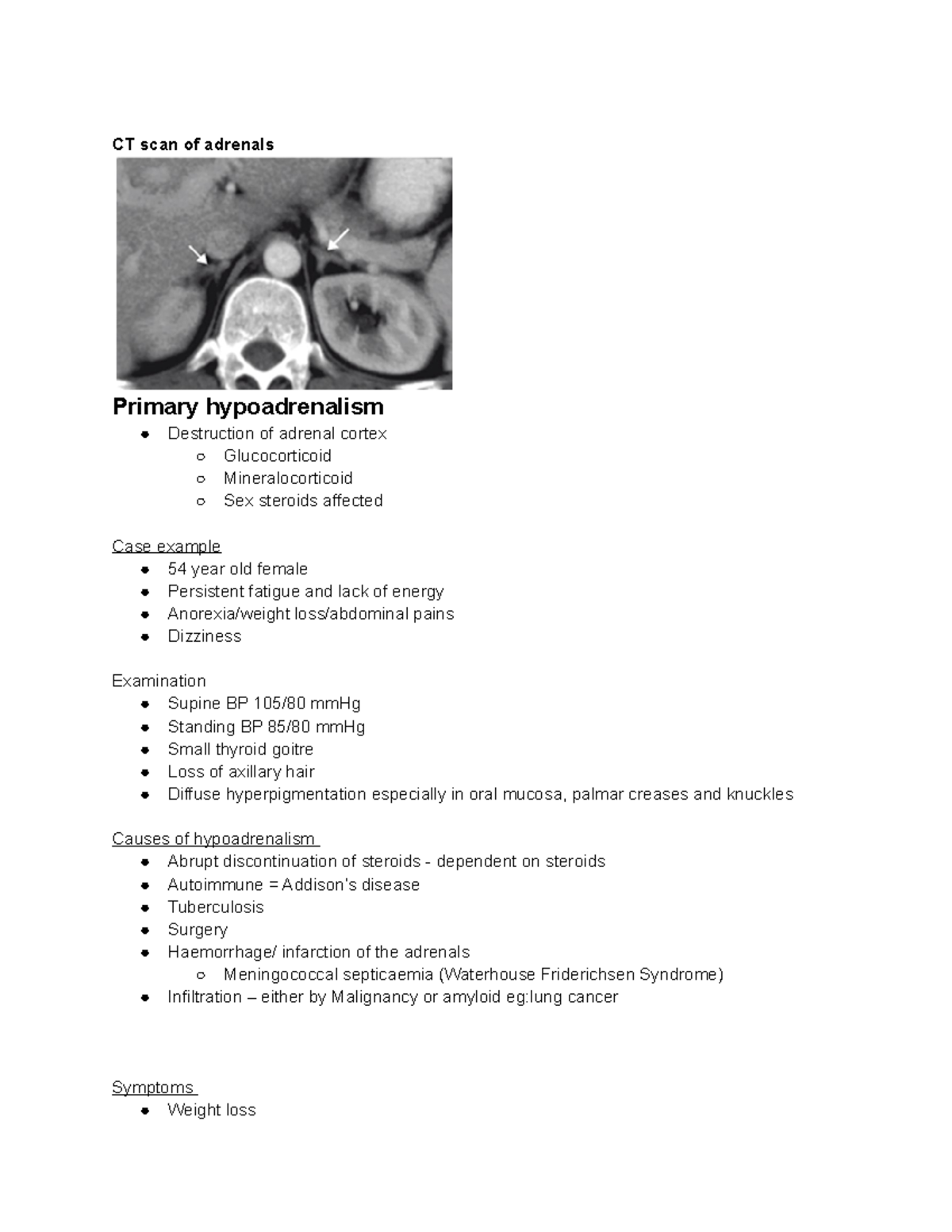 Adrenal - clinical - MBBS2 - CT scan of adrenals Primary hypoadrenalism ...