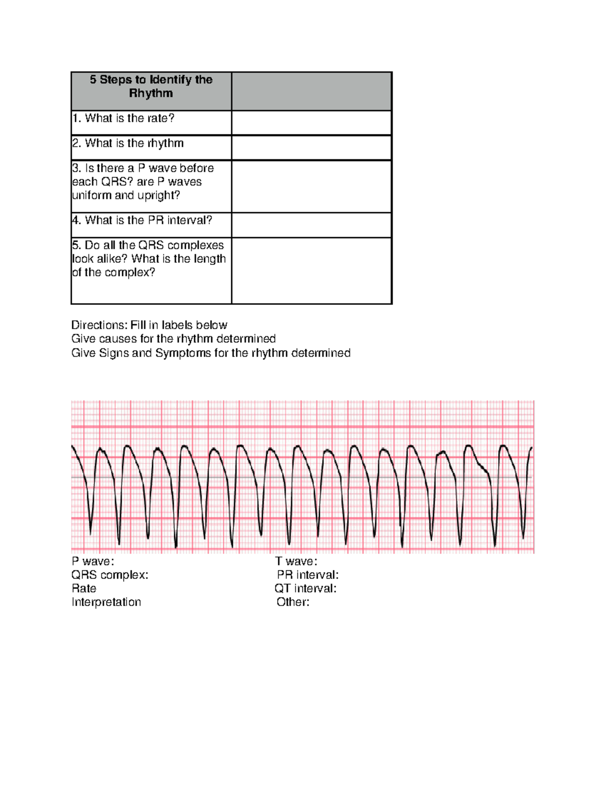 Ecg assignment - 5 Steps to Identify the Rhythm What is the rate? What ...