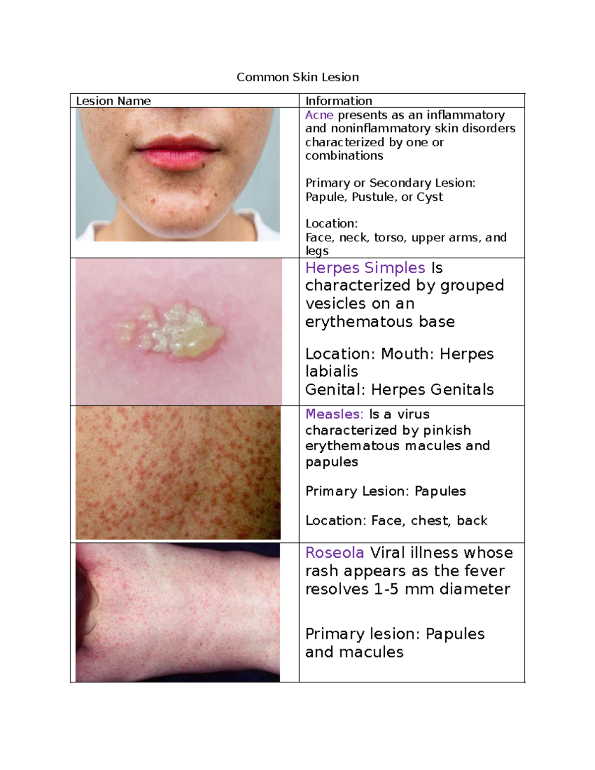 Common Skin Lesion - Common Skin Lesion Lesion Name Information Acne ...