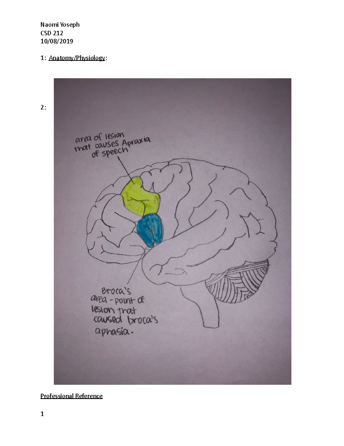Case study 1 - case studies - CSD 212 10/08/ 1: Anatomy/Physiology: 2 ...