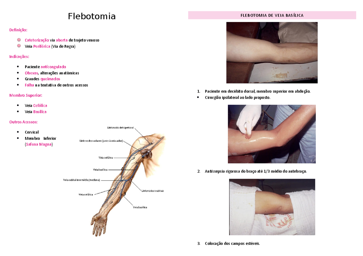 Flebotomia - Flebotomia Definição: Cateterização via aberta de trajeto ...