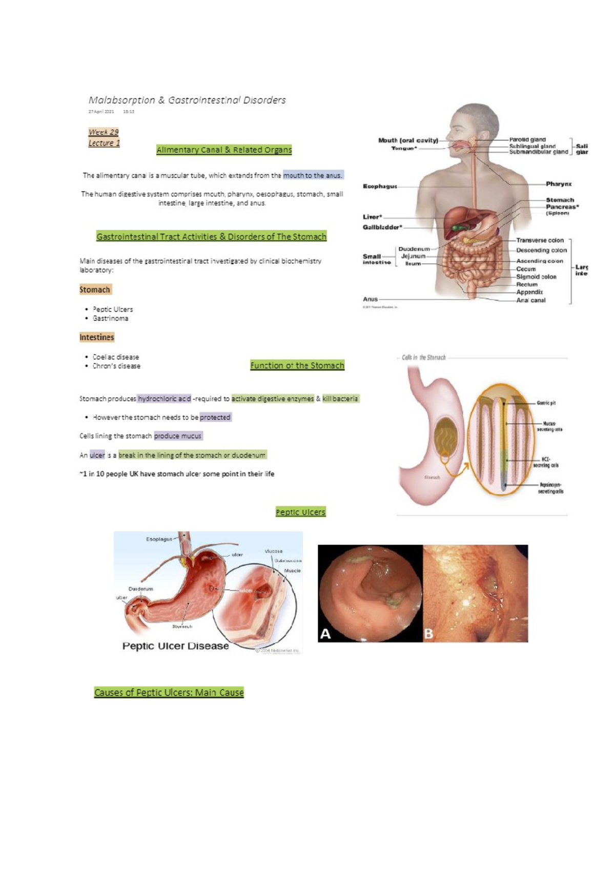 Diseases of the large intestine - Diseases of the large intestine ...