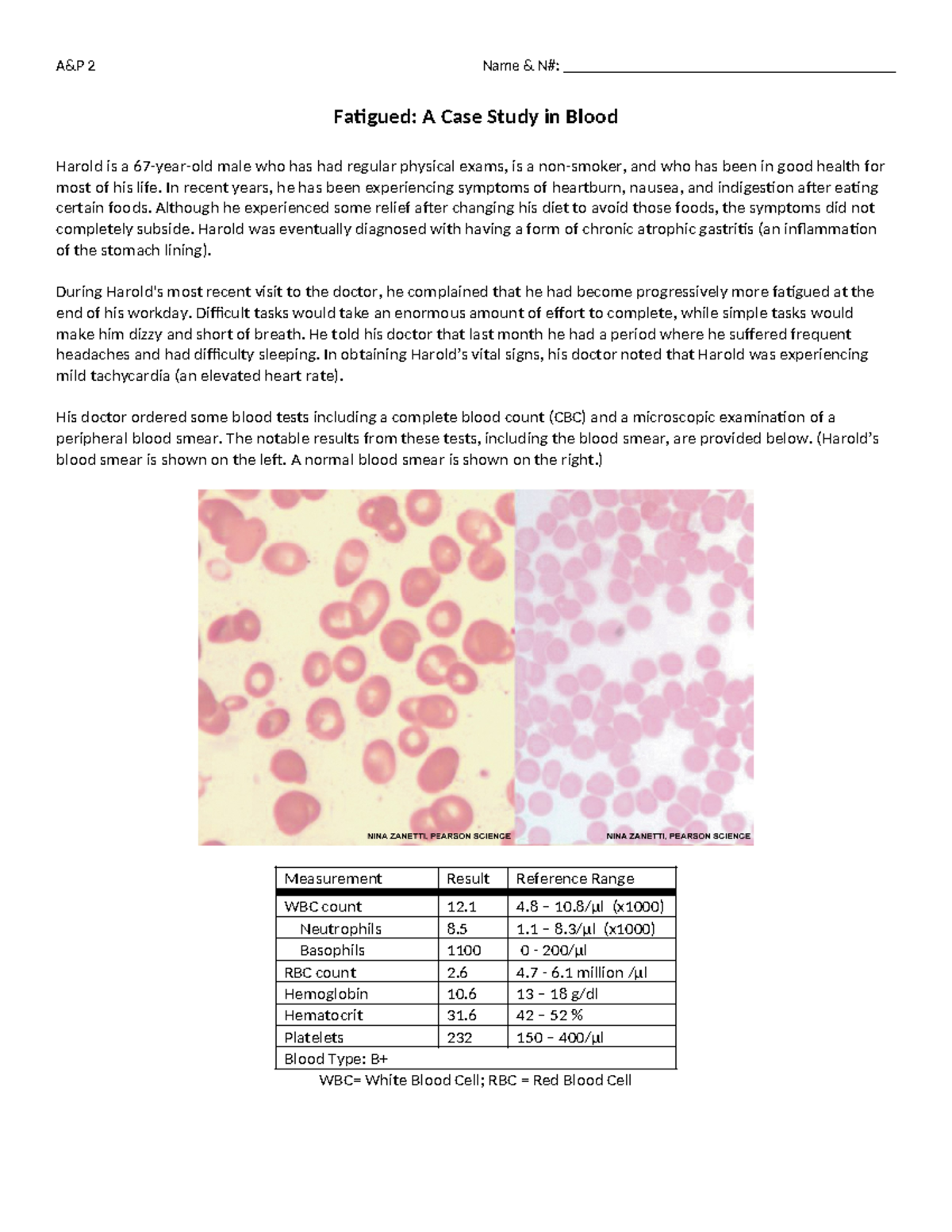Blood Case Study Nicole Linebaugh - A&P 2 Name & N#: - Studocu