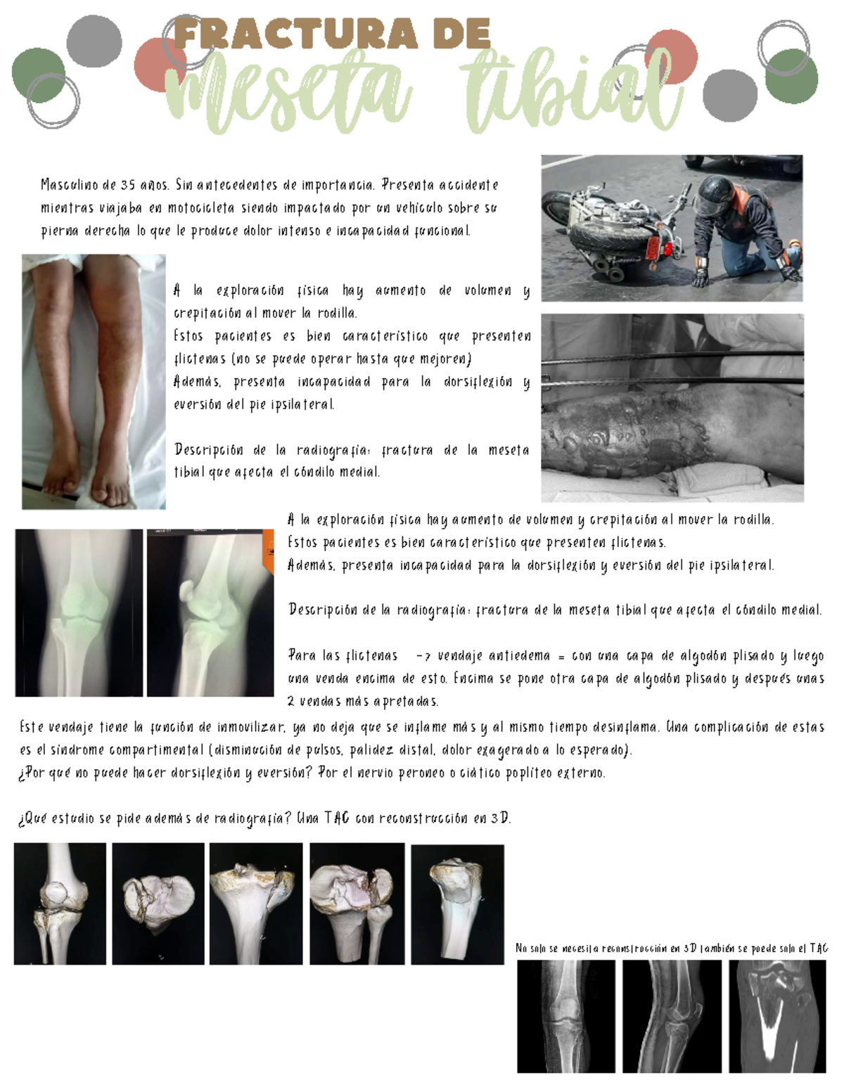 Meseta Tibial - A la exploración física hay aumento de volumen y ...