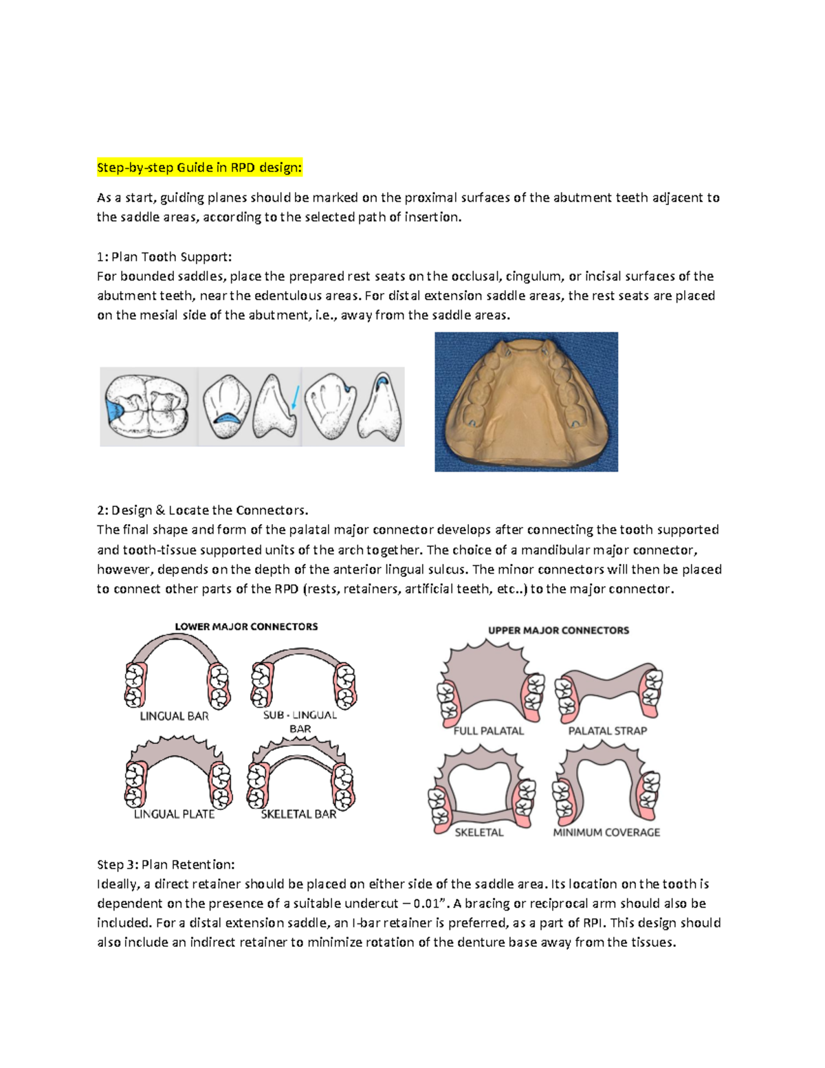 Step by step guide rpd drawing - Step-by-step Guide in RPD design: As a ...